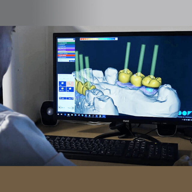 Implantology | Articles | Cortex - Dental