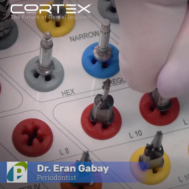 Trapped tooth | MAGIX implant | Case Studies | Cortex - Dental