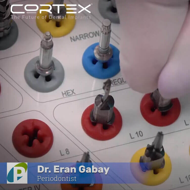 Trapped tooth | MAGIX implant | Case Studies | Cortex - Dental