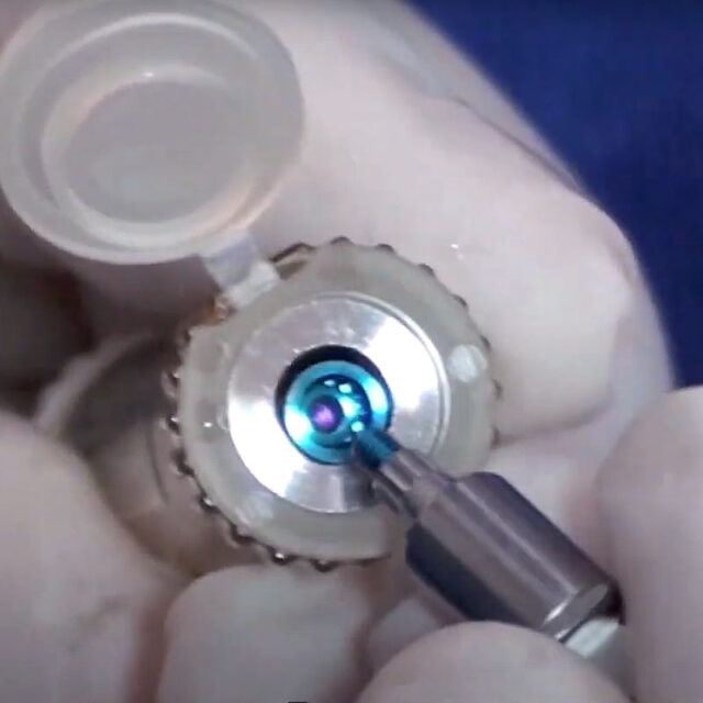 Guided implant planning | Case Studies | Cortex - Dental